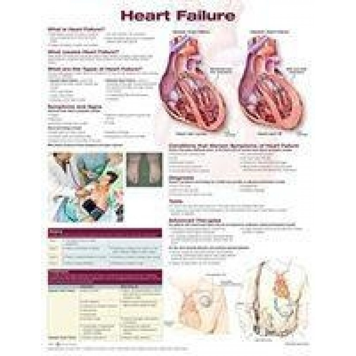 Anatomical Chart Company Heart Failure - School Locker Anatomical Chart Company Heart Failure - School Locker