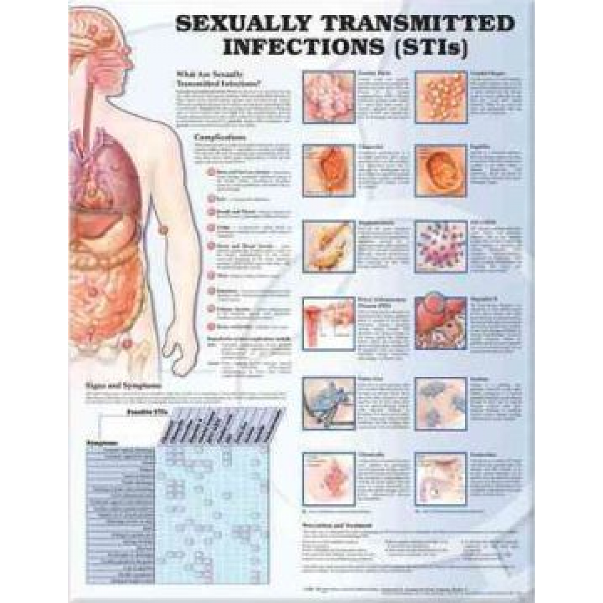 Anatomical Chart Company Sexually Transmitted Infections Anatomical