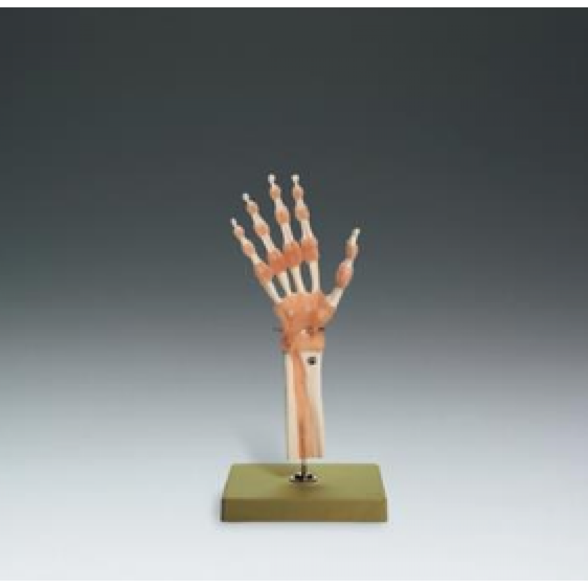 Anatomical Chart Company Functional Model of the Hand and Wrist ...