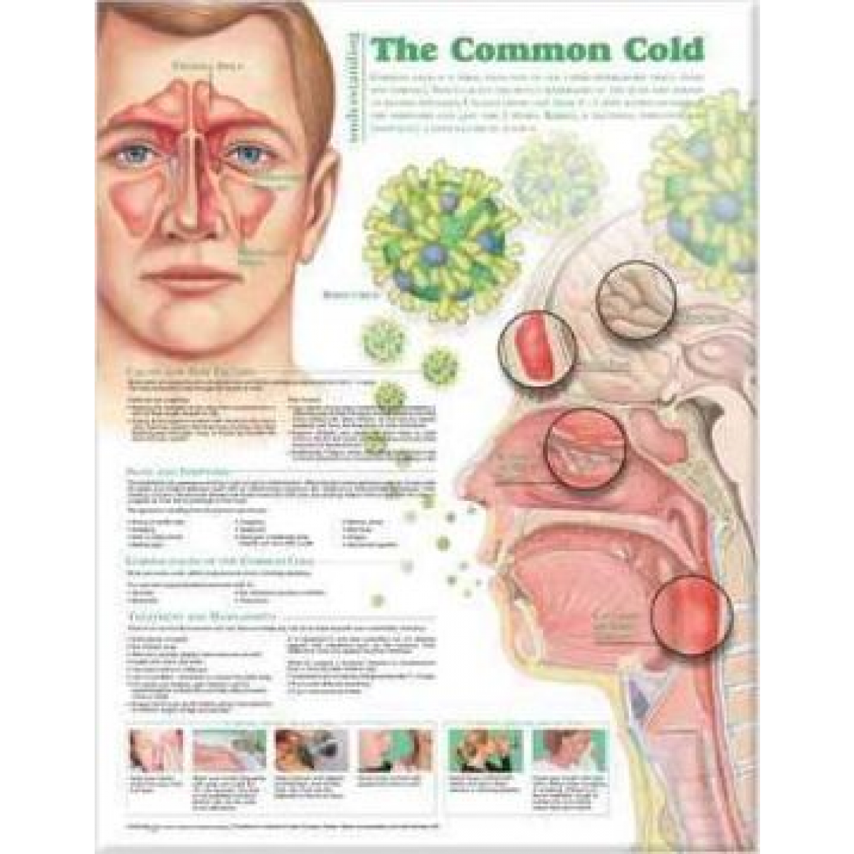 Anatomical Chart Company Understanding the Common Cold Anatomical Chart ...