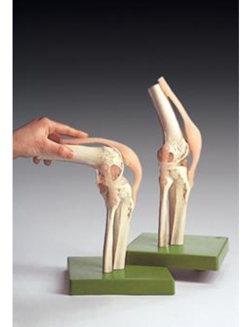 Anatomical Chart Company Functional Model of the Knee Joint - School Locker