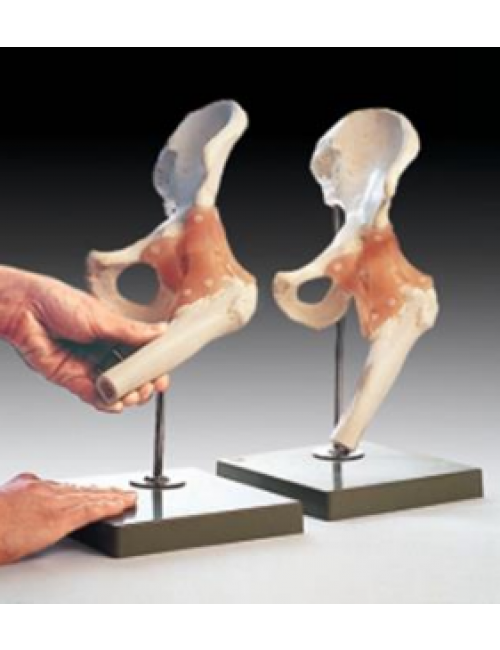 Anatomical Chart Company Functional Model of the Hip Joint - School Locker